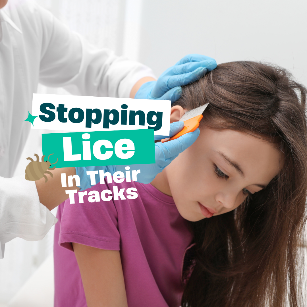 Treating Head Lice in Kids